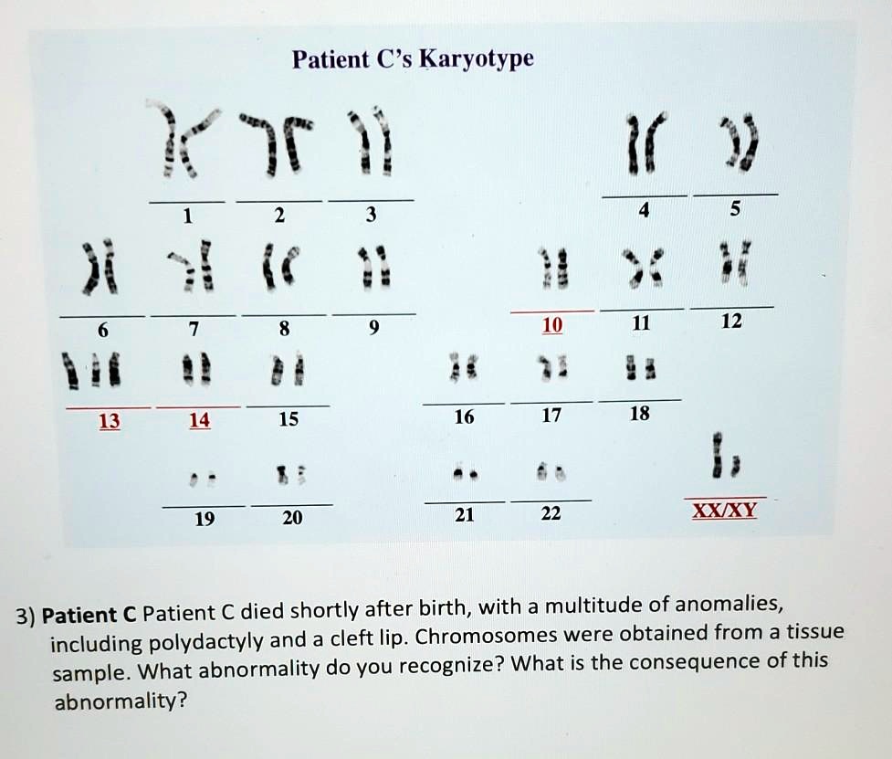 SOLVED: Patient C's Karyotype T0 10 12 13 14 15 17 18 19 20 22 XX KXY 3 ...