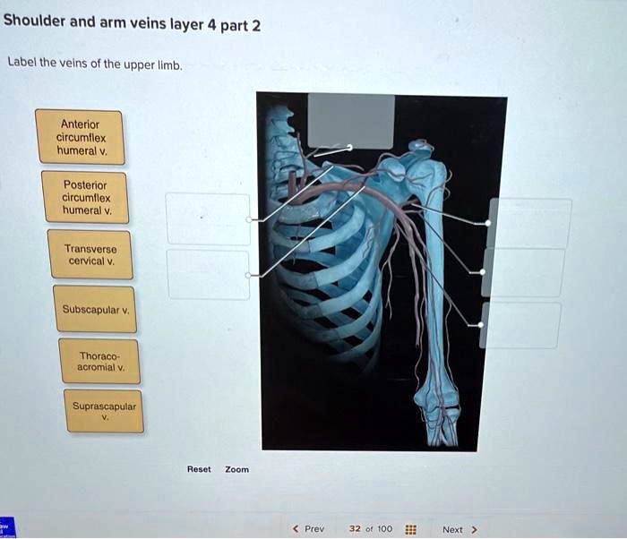 SOLVED: Shoulder and arm veins layer 4 part 2 Label the veins of the upper limb Anterior ...
