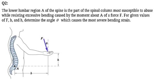 Q2: The lower lumbar region A of the spine is the part of the spinal ...