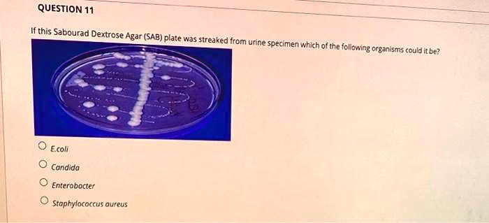QUESTION 11 If this Sabourad Dextrose Agar (SAB) plate was streaked ...