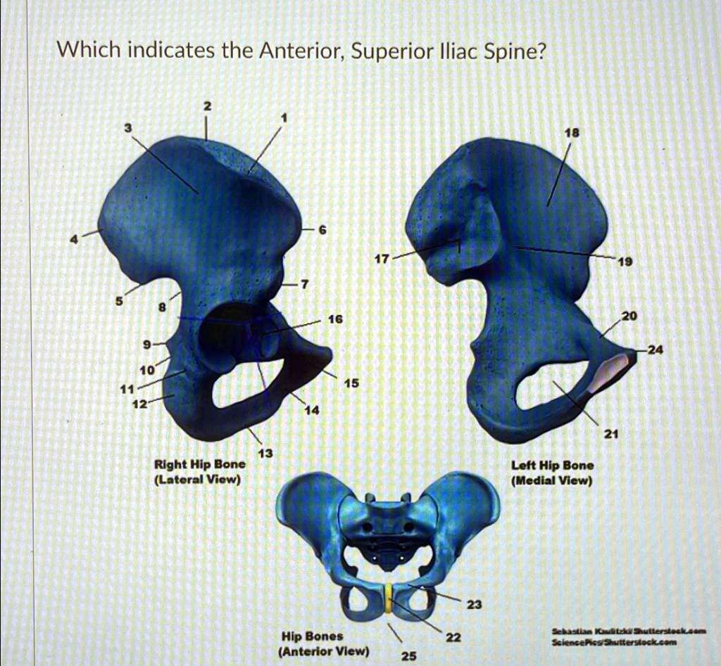 Which indicates the Anterior, Superior Iliac Spine?