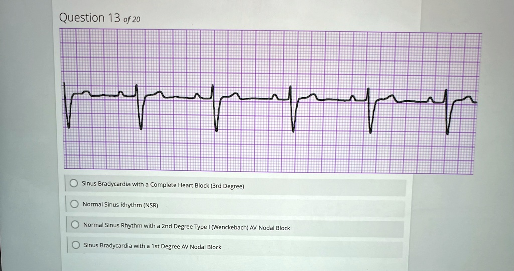 question 13 of 20 sinus bradycardia with a complete heart block 3rd ...