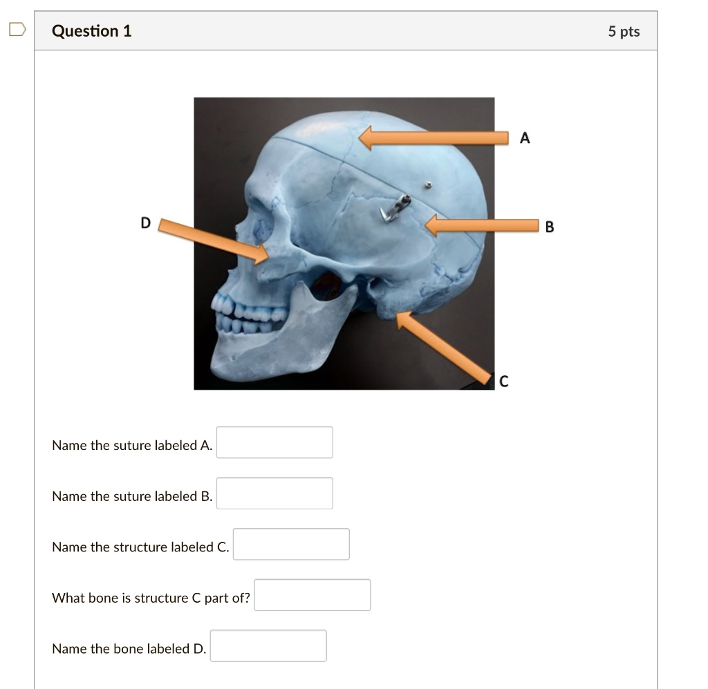 Question 1 5 pts A D B Name the suture labeled A Name the suture ...