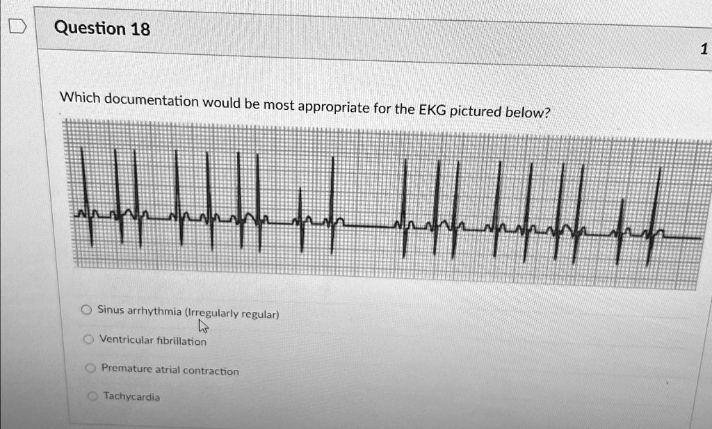 Question 18 Which documentation would be most appropriate for the EKG ...