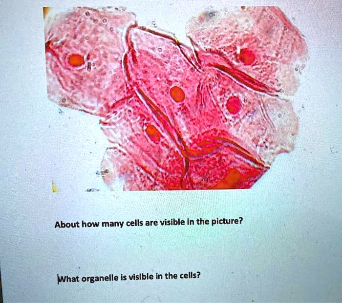 SOLVED: About how many cells are visible in the picture? What organelle ...