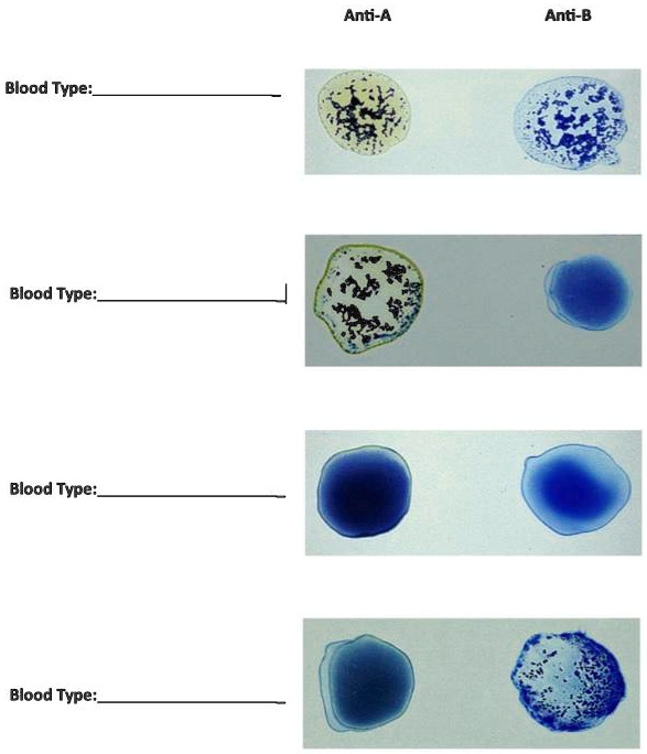 SOLVED: On this blood types document, identify the different blood ...