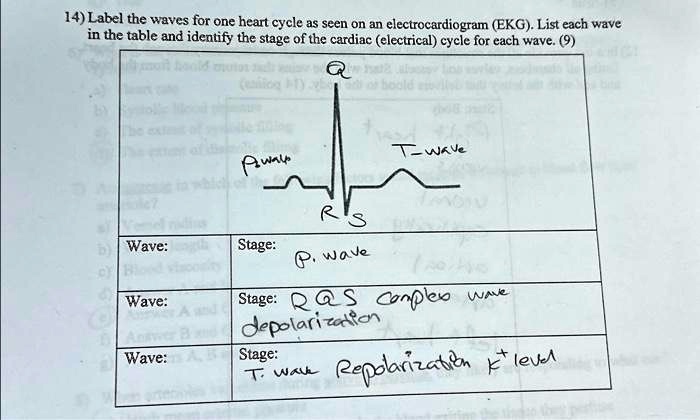Wave: P wave Stage: Atrial depolarization Wave: QRS complex Stage ...