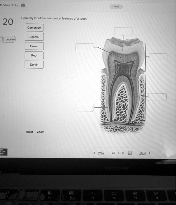 Module 3 Quiz Seved Correctly label the anatomical features of a tooth ...