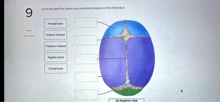 SOLVED: Correctly label the bones and anatomical features of the fetal ...