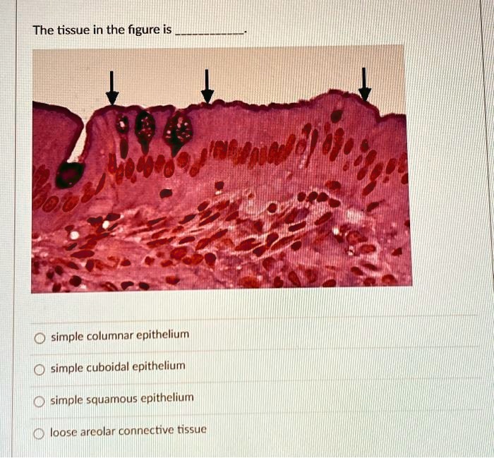 SOLVED: The tissue in the figure is @simple columnar epithelium @simple cuboidal epithelium ...