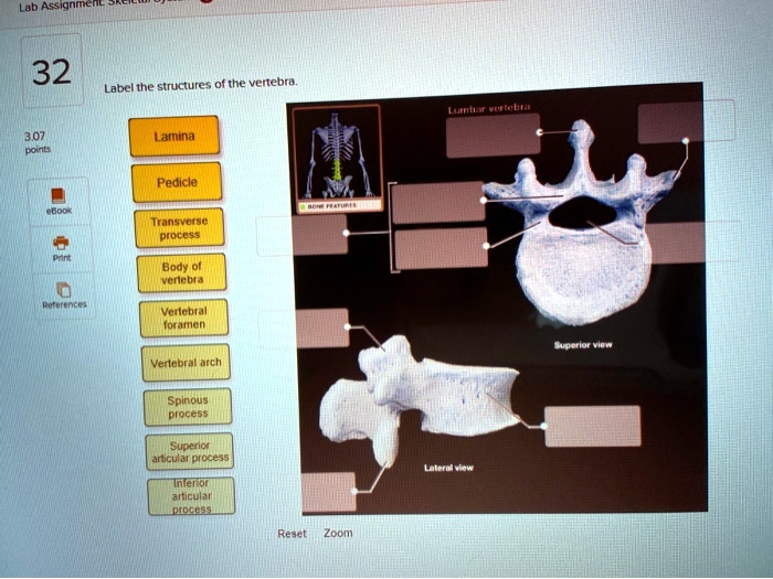 SOLVED: Lab Assignment 32: Label the structures of the vertebrae. 3.07 points Lamina Pedicle ...