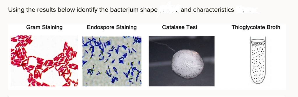 SOLVED: 'Using the results below identify the bacterium shape and ...