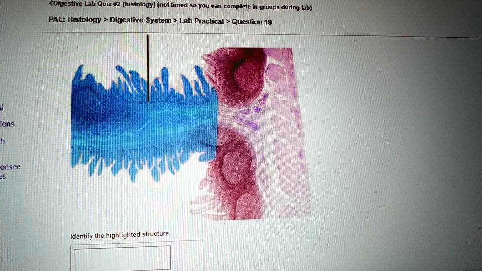 SOLVED: Digestive Lab Quiz #2 (Histology) (not timed so you can ...