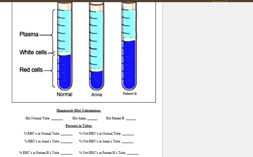 Plasma White cells Red cells Normal Anna Patient B Hematocrit (Hct) Calculations: Het Normal ...
