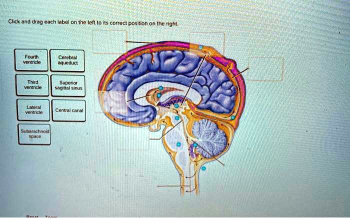 SOLVED: Click and drag each label on the left to its correct position on the right. Click and ...
