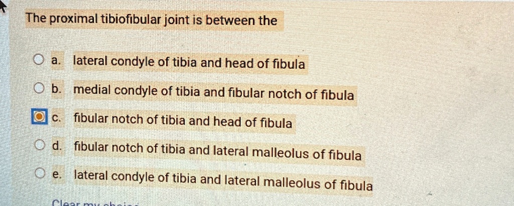 the proximal tibiofibular joint is between the a lateral condyle of ...
