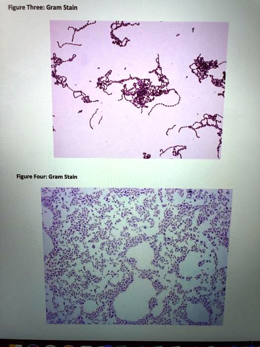 SOLVED: Figure Three: Gram Stain Figure Four: Gram Stain SOLVED: Figure Three: Gram Stain Figure Four: Gram Stain
