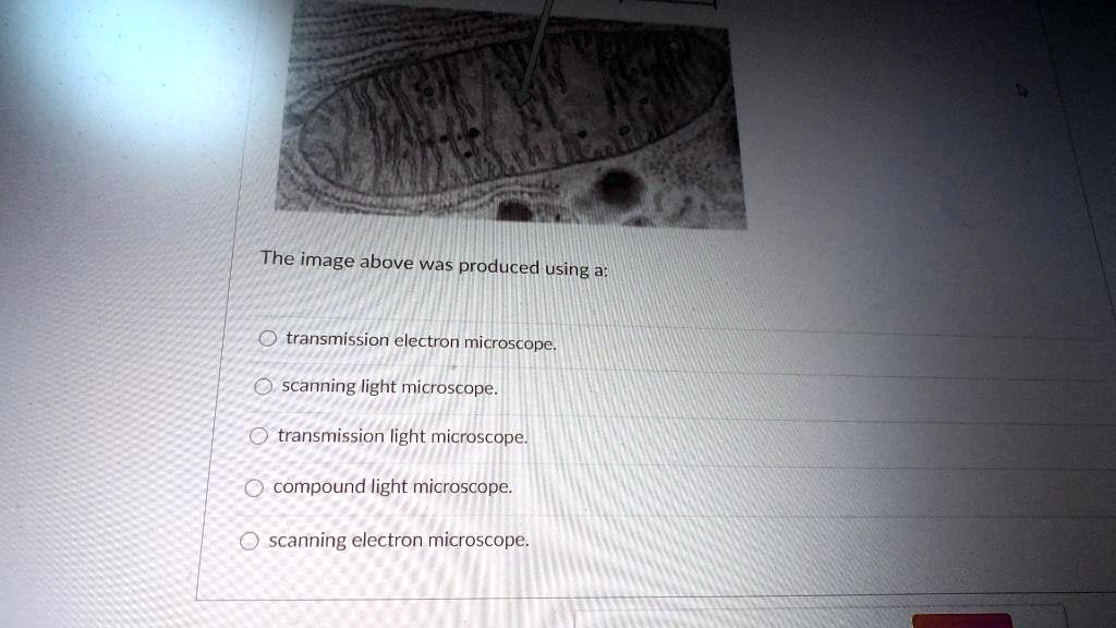 SOLVED: The image above was produced using transmission electron ...