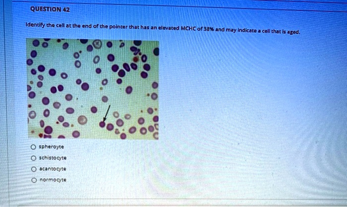 SOLVED: Question 42 Identify the cell at the end of the MCH of 38* and ...
