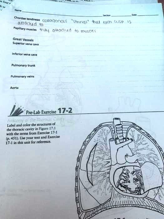 Great Vessels: Superior vena cava, Inferior vena cava, Pulmonary veins ...