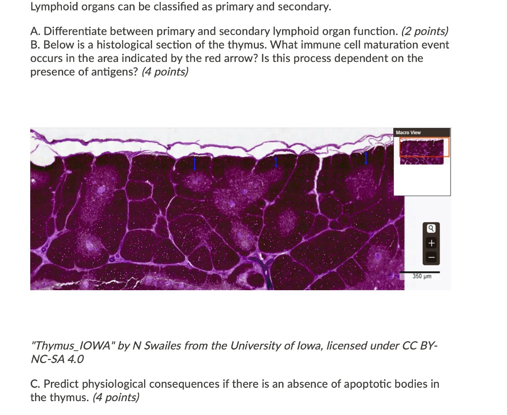 SOLVED: Lymphoid organs can be classified as primary and secondary. A ...