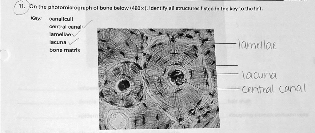 11. On the photomicrograph of bone below (480×), identify all structures listed in the key to ...