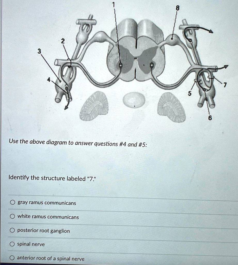SOLVED: Use the above diagram to answer questions #4 and #5: Identify ...