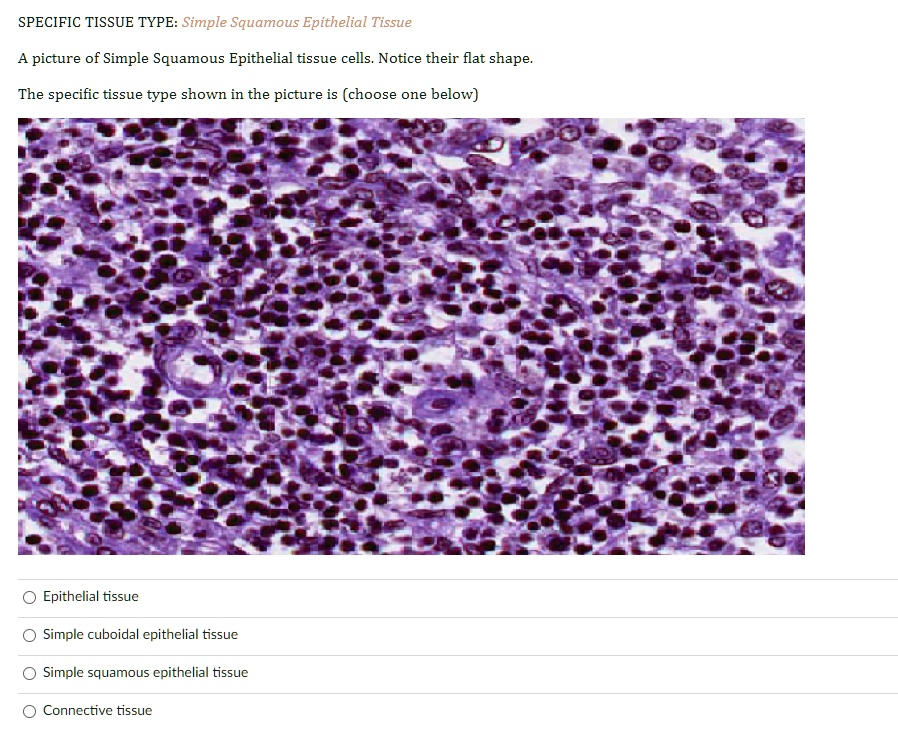 SOLVED: SPECIFIC TISSUE TYPE: Simple Squamous Epithelial Tissue A ...