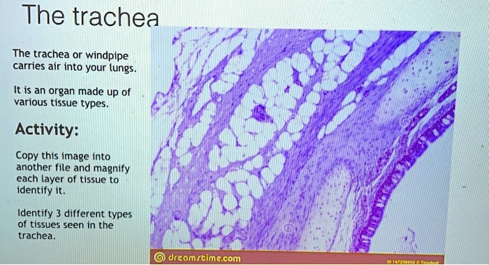 The trachea The trachea or windpipe carries air into your lungs. It is ...