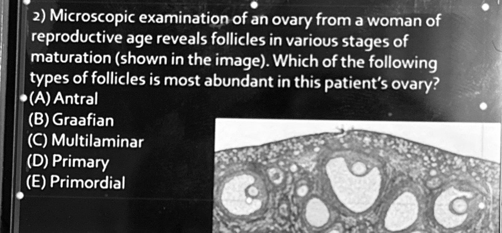SOLVED: Microscopic examination of an ovary from a woman of ...