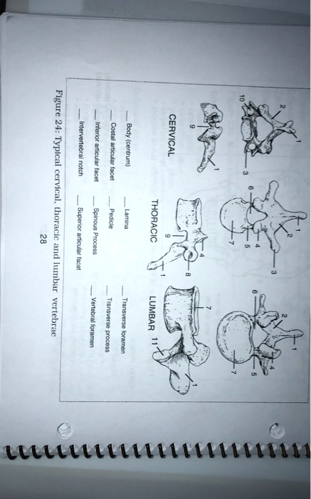 10 9 3 CERVICAL 9 THORACIC 3 8 7 LUMBAR 11 Body (centrum) Lamina ...