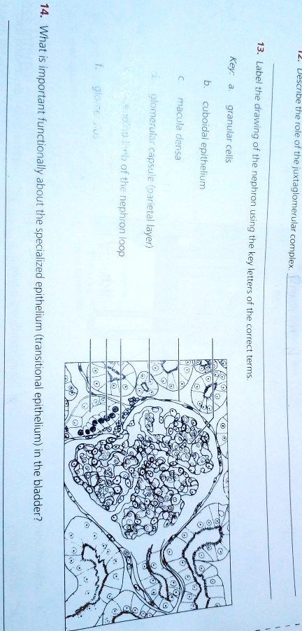 12. Describe the role of the juxtaglomerular complex. 13. Label the ...