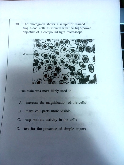 SOLVED: The photograph shows sample stained Trog blood cells as viewed with the high-power ...