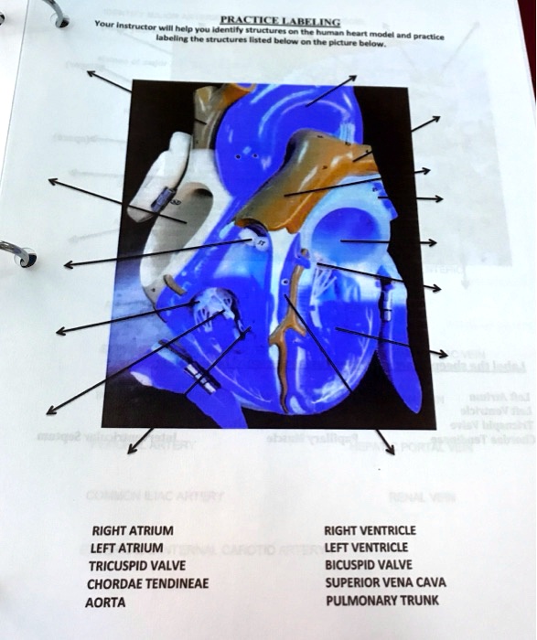 SOLVED: Practice Labeling Right Atrium Left Atrium Tricuspid Valve ...