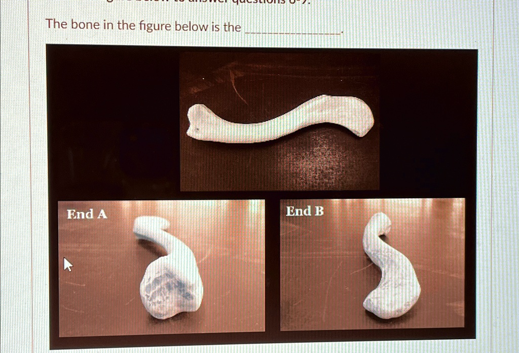 The bone in the figure below is the q, The bone in the figure below is ...