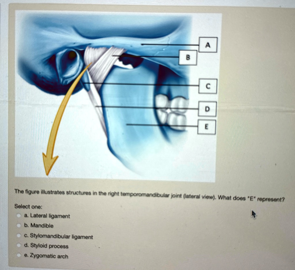 A B C D E The figure illustrates structures in the right ...