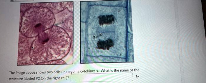 The image above shows two cells undergoing cytokinesis. What is the ...