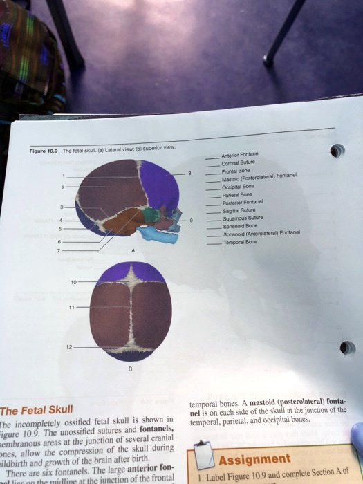 SOLVED: Figure 10.9The fetal skull (aLateral view;b superiorview ...