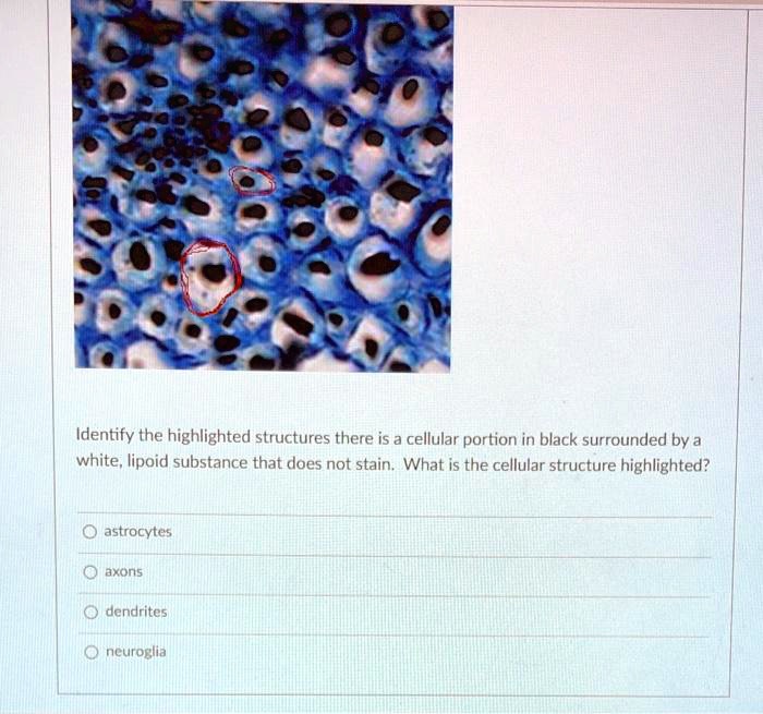 SOLVED: Identify the highlighted structures there is a cellular portion ...
