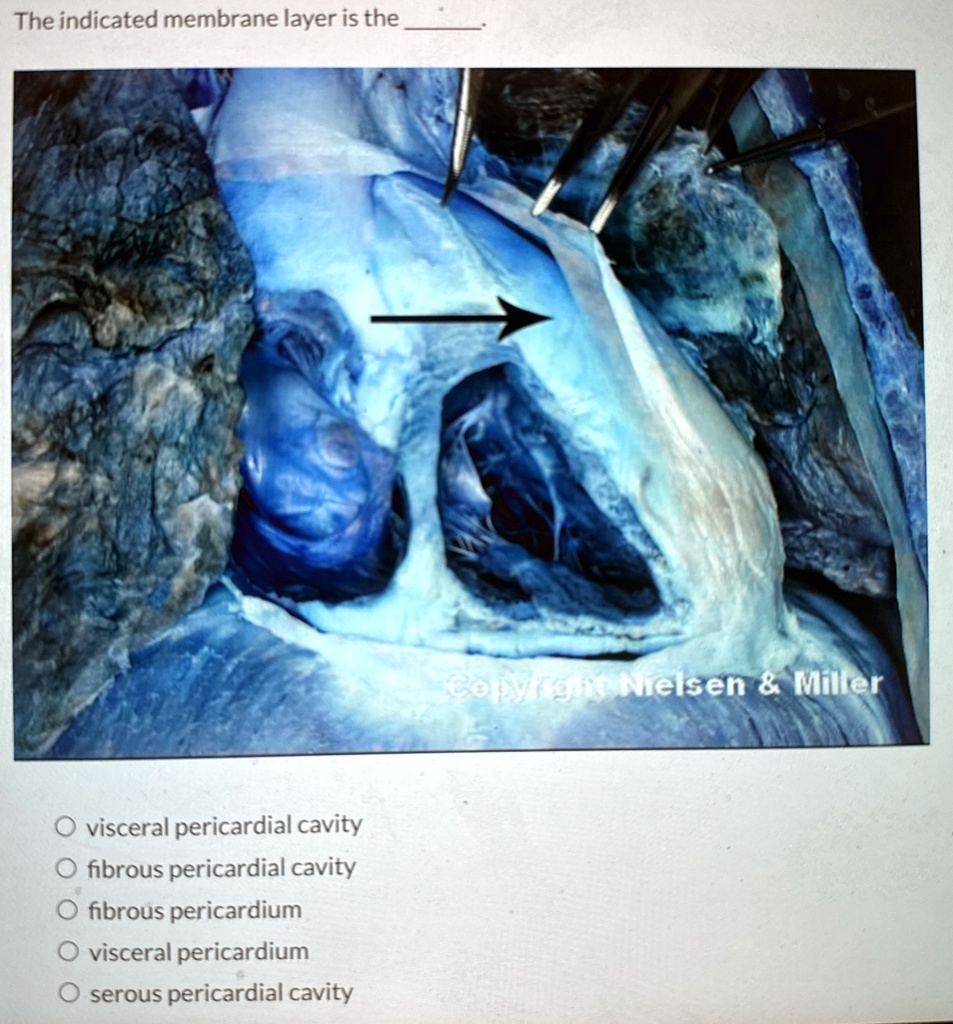 The indicated membrane layer is the O visceral pericardial cavity O ...