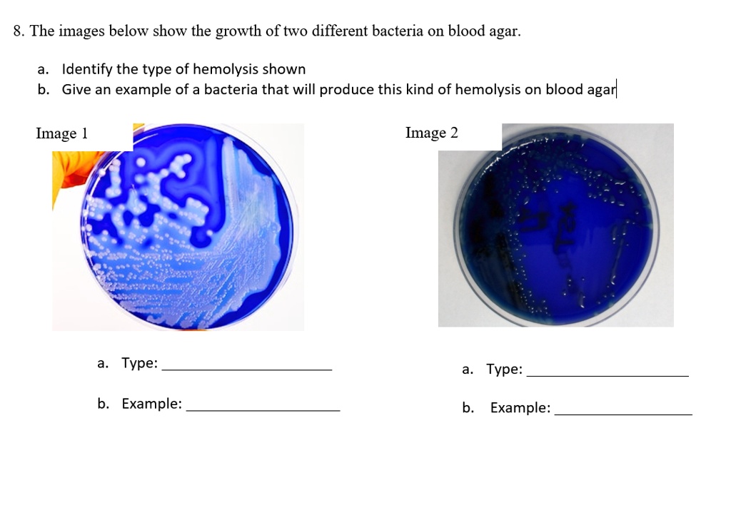 Types Of Hemolysis On Blood Agar at Dorothy Logan blog