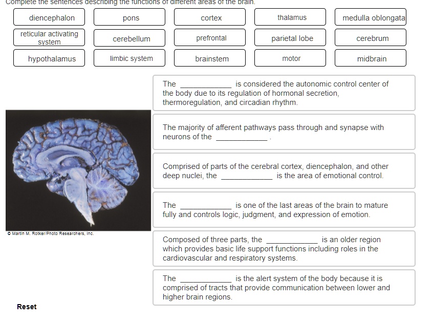 SOLVED: diencephalon pons cortex thalamus medulla oblongata reticular activating system ...