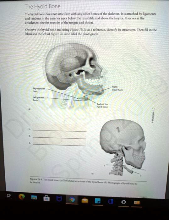 The Hyoid Bone The hyoid bone does not articulate with any other bones ...