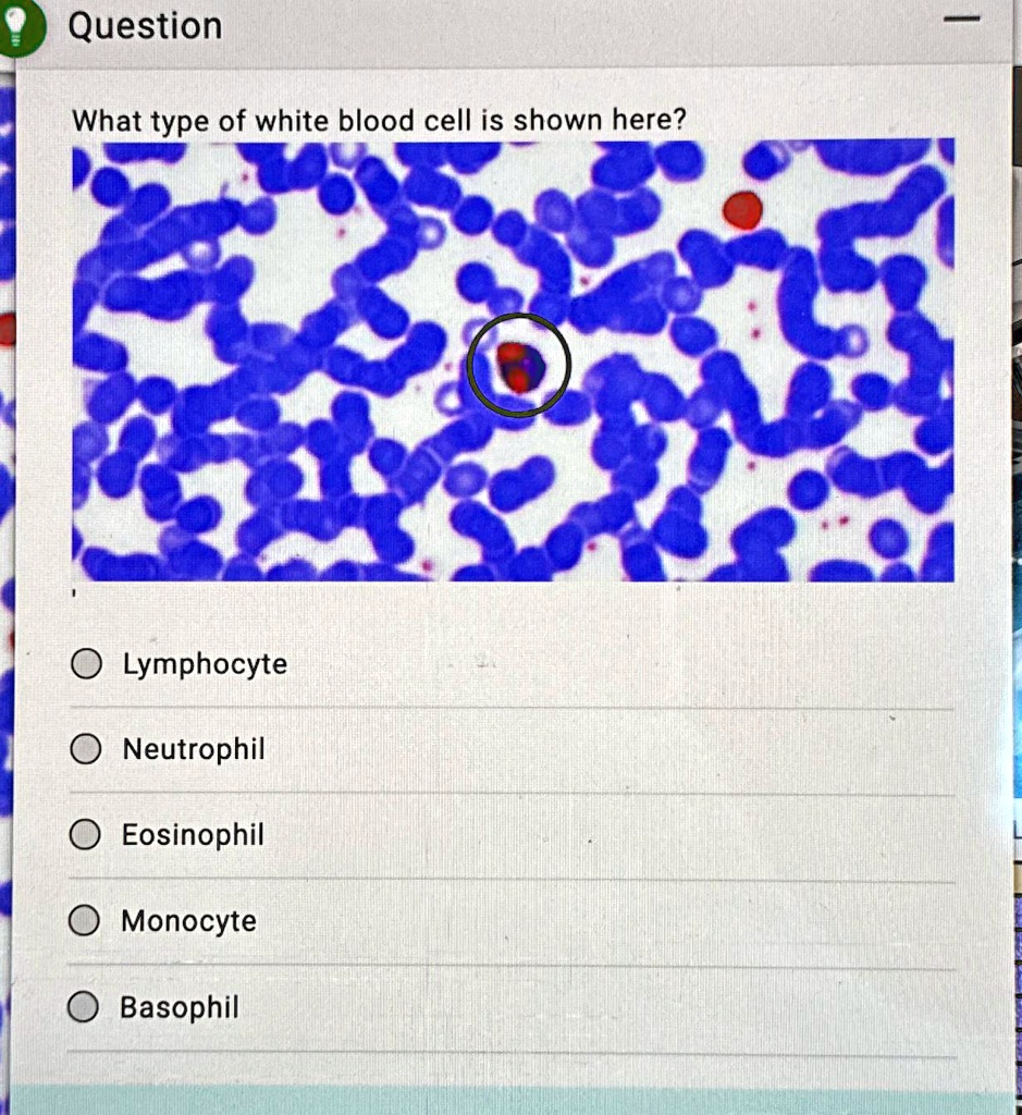 SOLVED: Question What type of white blood cell is shown here ...