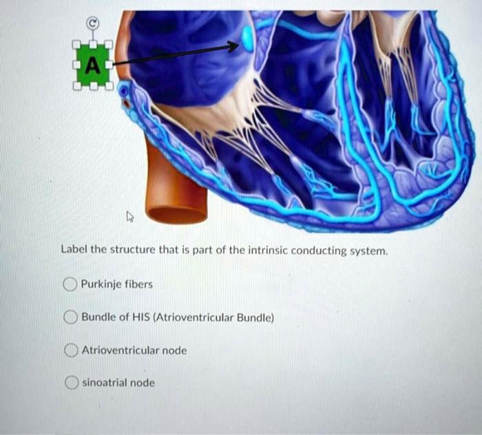 Label the structure that is part of the intrinsic conducting system ...