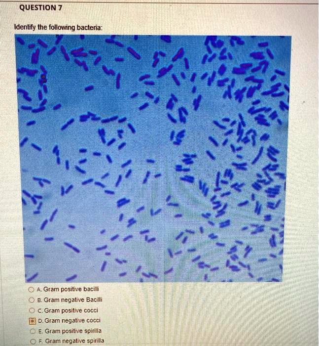 SOLVED: Identify the following bacteria: A. Gram-positive bacilli B. Gram-negative bacilli C ...