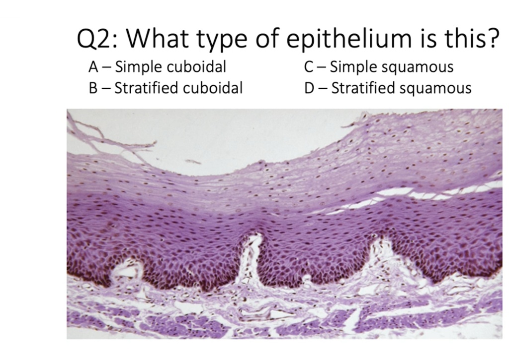 what type of epithelium is this a simple cuboidal c simple squamous b ...