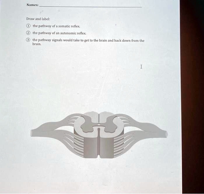 Names: Draw and label: ? the pathway of a somatic reflex.