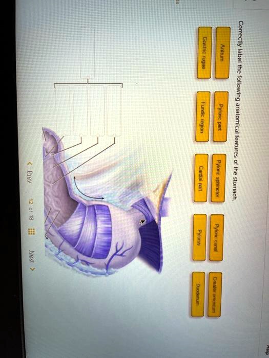 SOLVED: Gastric rugae, Atrium, Fundic region, Pyloric part. Correctly ...