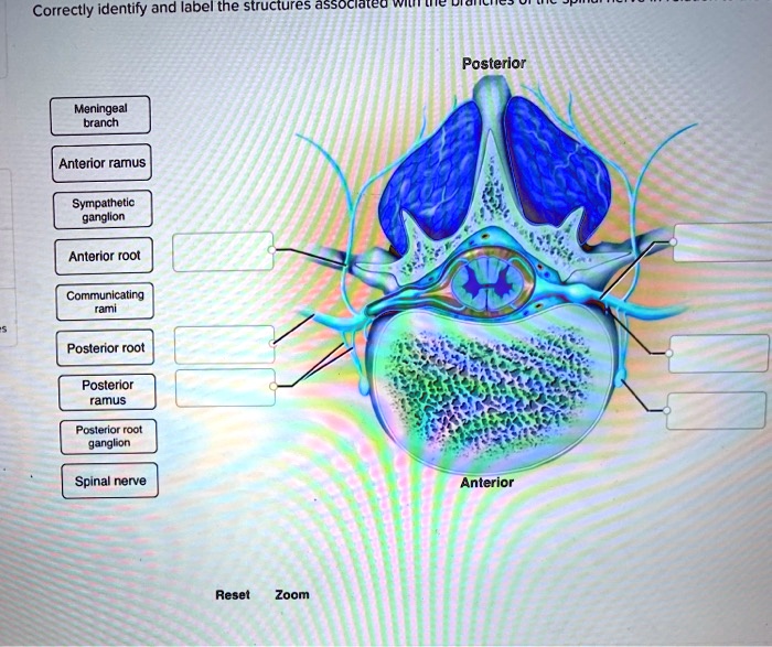 SOLVED: Correctly identify and label the structures associated with: - Posterior meningeal ...